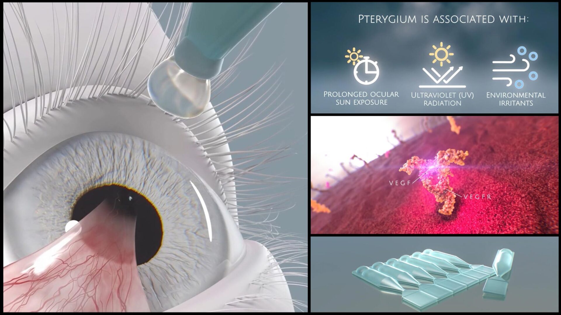 4 Examples of Beautiful Ophthalmology Animation That Showcase the ...